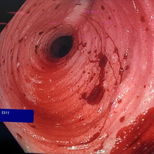 Biliary Tract Model Pulsemdm